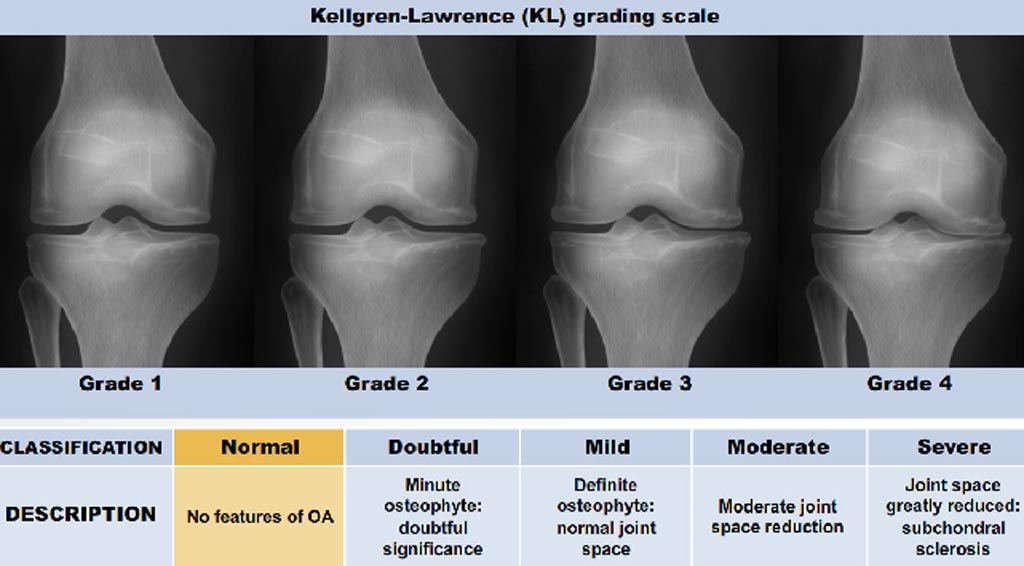 TradeMed Industry News AI Could Help Radiologists Improve