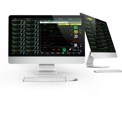 Central Monitoring System | BioVision | Medical Equipment and devices ...