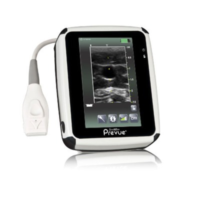Portable Ultrasound System | Site-Rite Prevue+ | Equipos y dispositivos ...