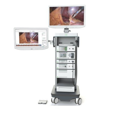 Endoscopy System | EndoSURGERY | Medical Equipment and devices for ...