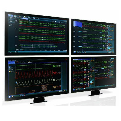 Centralized Patient Monitor | Xhibit Central Station | Medical ...