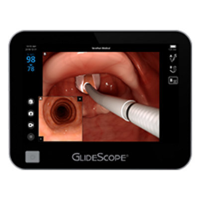Airway Visualization System | GlideScope Core | Medical Equipment and ...