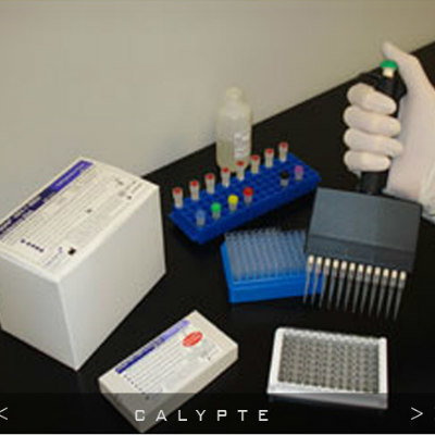 HIV Test | AWARE BED EIA TEST | Medical Equipment and devices for ...